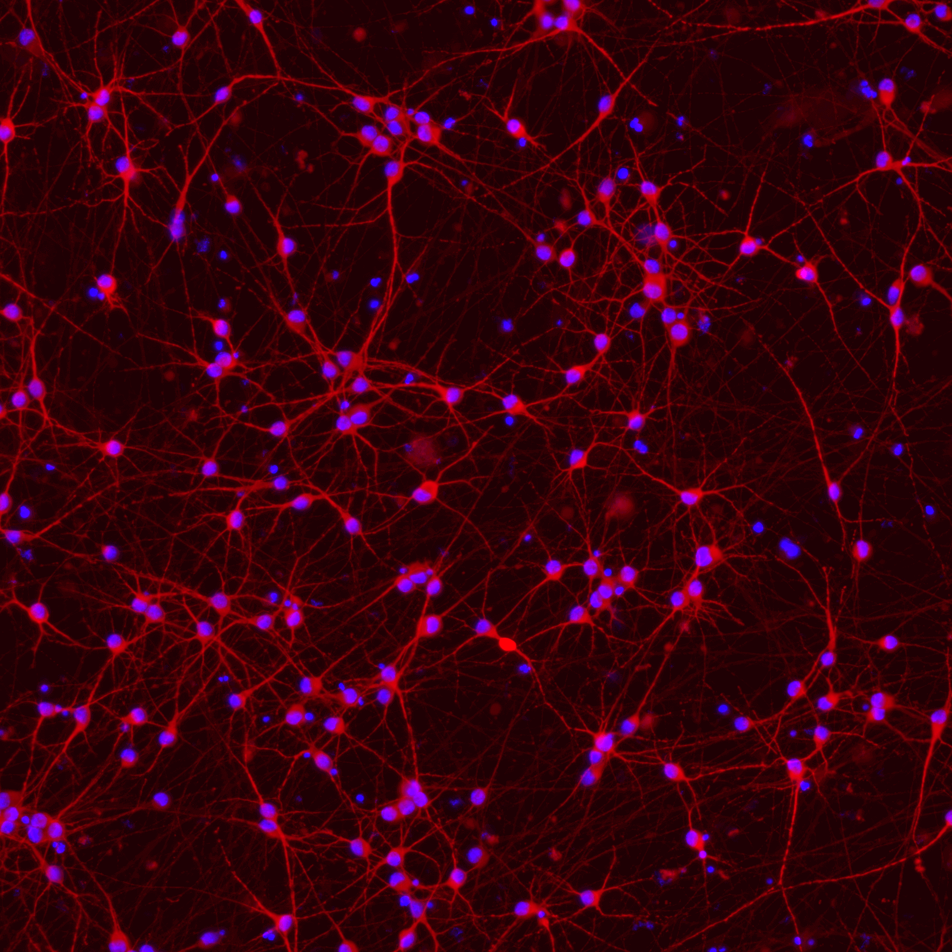 Glutamatergic Neurons PSEN1 M146L homozygous | ioCells